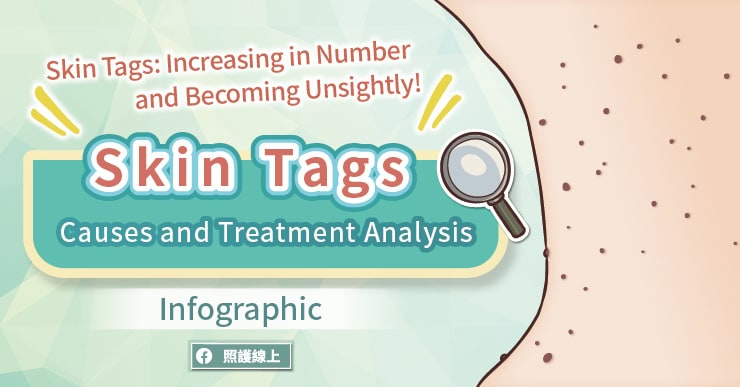 Tiny skin tags popping up everywhere? So annoying! Let’s dive into the ...